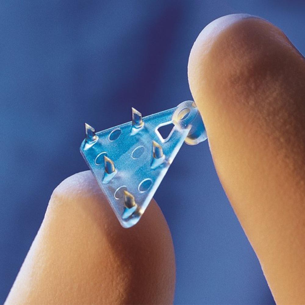 Endotine Forehead implantaat - Trango Medical